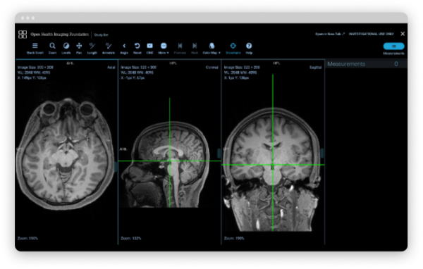Neuroimaging Research Platform | Flywheel