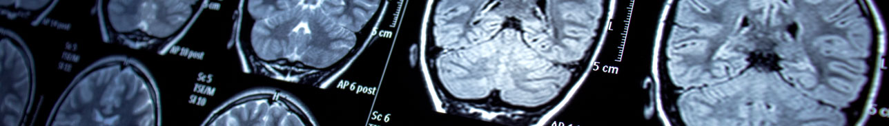 Our Story: Transforming Imaging Research & AI | Flywheel