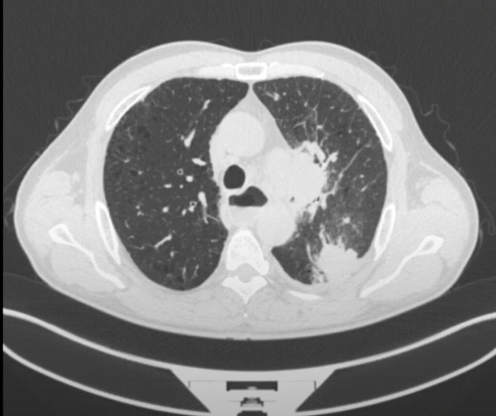 Flywheel | Medical Image Analysis Software