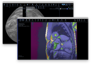 Medical Imaging Platform | Flywheel